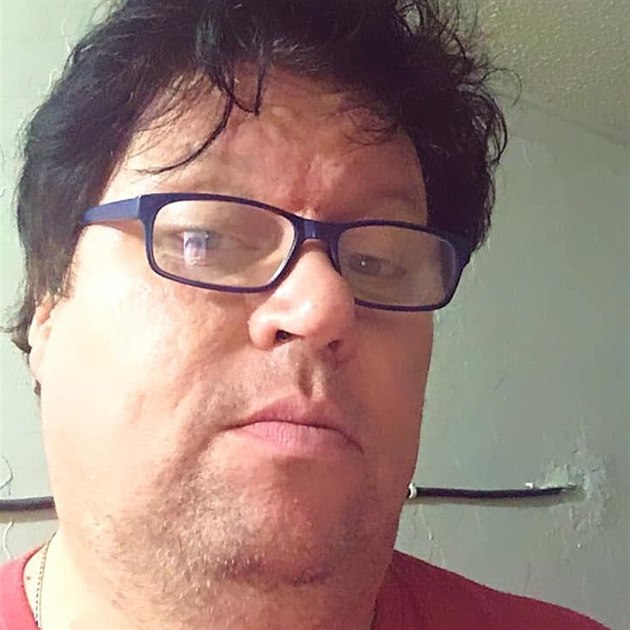 Fotogalerie: Timo Tolkki skončil na vozíku.