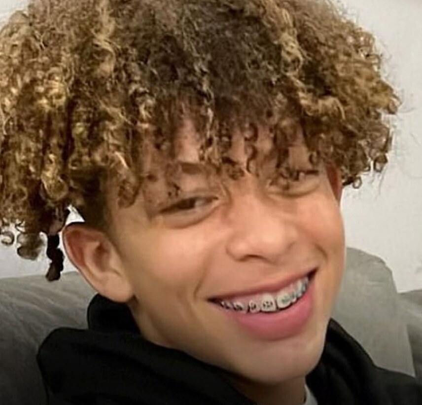 Fotogalerie: Mason Dark se léčí s popáleninami