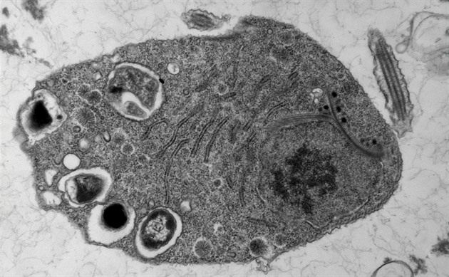 Monocercomonoides - Alchetron, The Free Social Encyclopedia