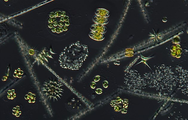 Fotogalerie: Sinice a řasy pod mikroskopem