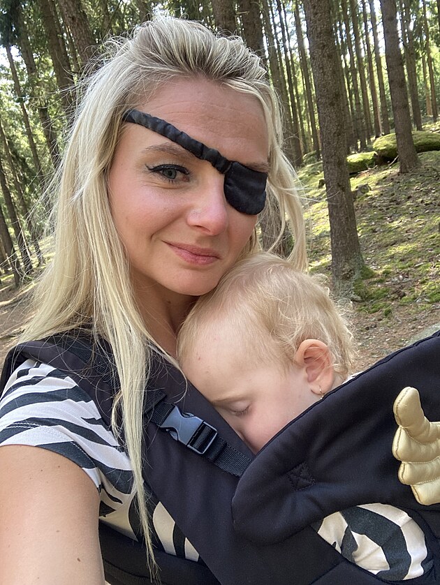 Po děsivé nehodě přišla o oko. Hendikep neskrývá, proměnila ho v přednost