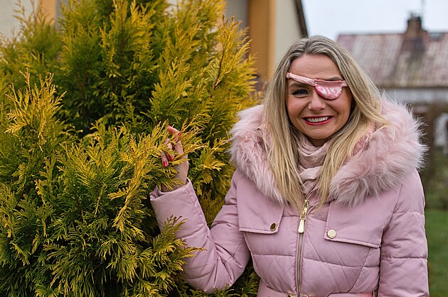 Po děsivé nehodě přišla o oko. Hendikep neskrývá, proměnila ho v přednost