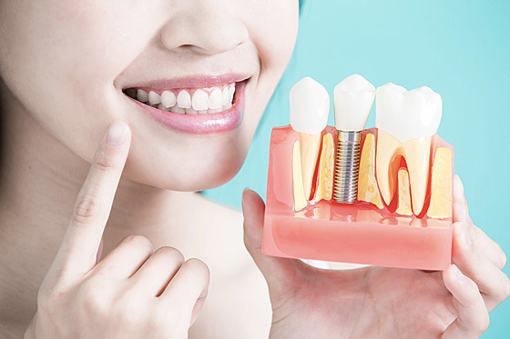 Zubní protézy, korunky, implantáty či můstky: Jaké řešení je nejlepší ...