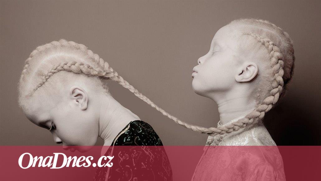 Černošce se narodila albínská dvojčata, nyní jsou žádaná v modelingu ...