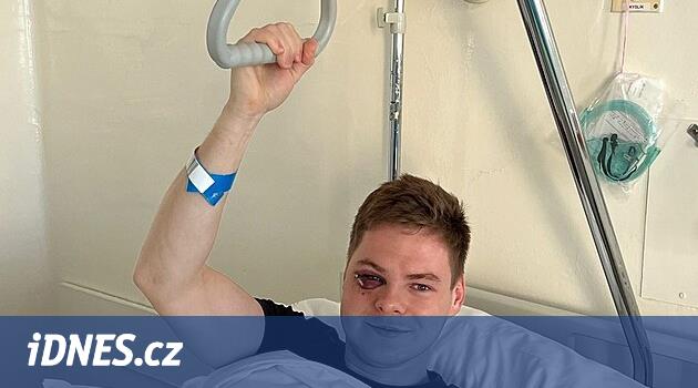 Monokl pod okem i zlomené kosti. Početná skupina napadla v Písku ...